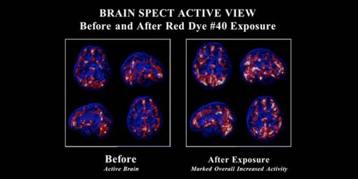 Red Dye #40 Can Make Non-ADD Kids Hyperactive & Alter Brain Function