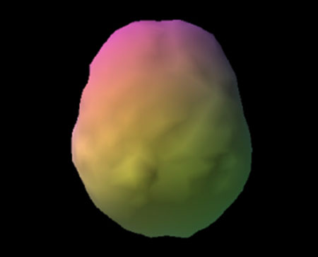 Treating Brain Toxicity & Brain Infection | Amen Clinics Amen Clinics